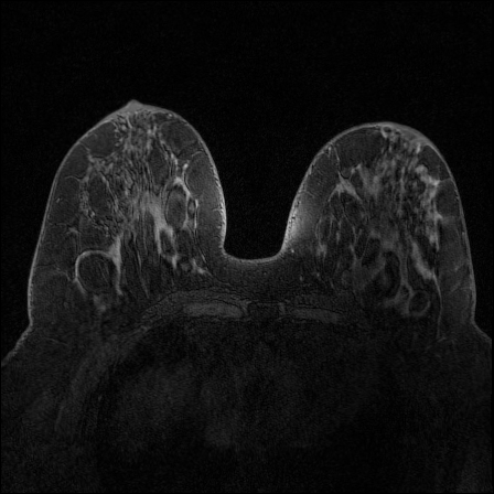 Reporting concerns on data leakage | ICLR Blogposts 2025